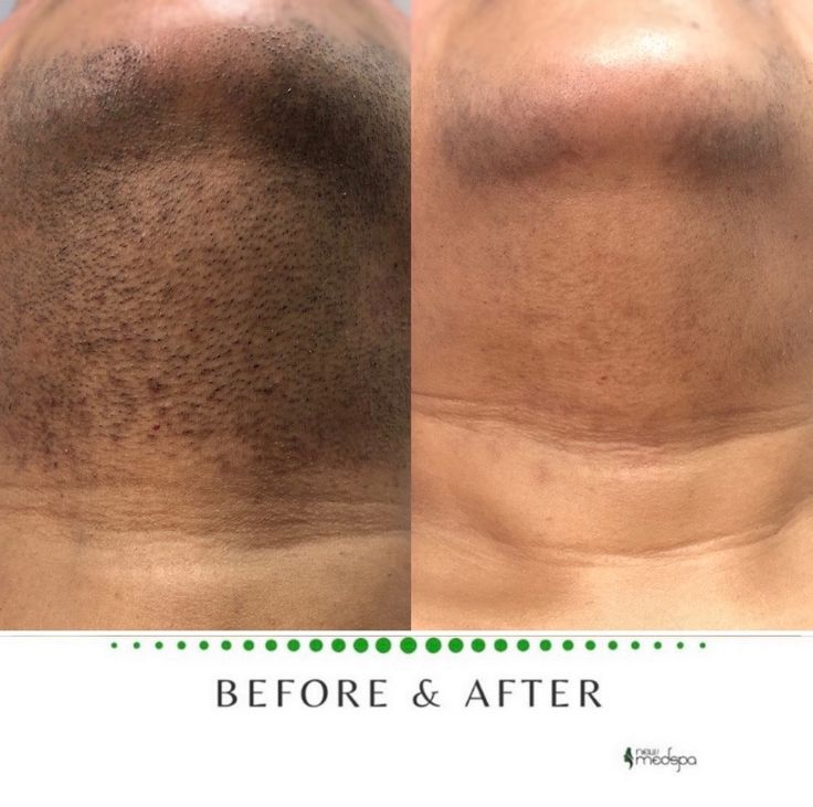 Enqu Facial and Hair Clinique | Expert Skin & Hair Treatments in Addis ...